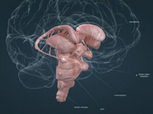 Comprendre le gliome infiltrant du tronc cérébral (GITC)